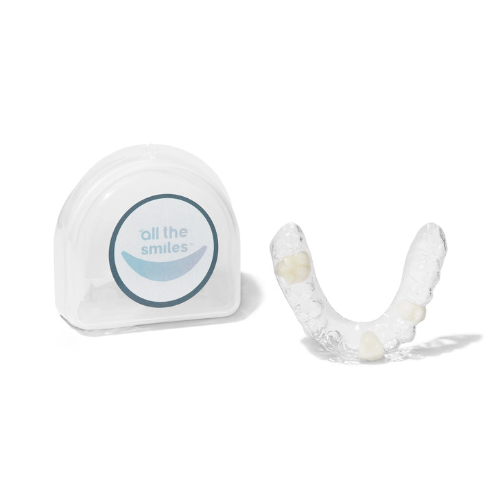 Custom Made Clear Essix Partial Denture Retainer Temporary - $169 ...